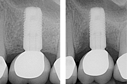 Allograft Histology | SteinerBio
