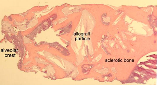 Allograft Histology | SteinerBio