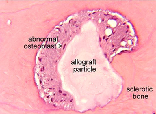 Allograft Histology | SteinerBio