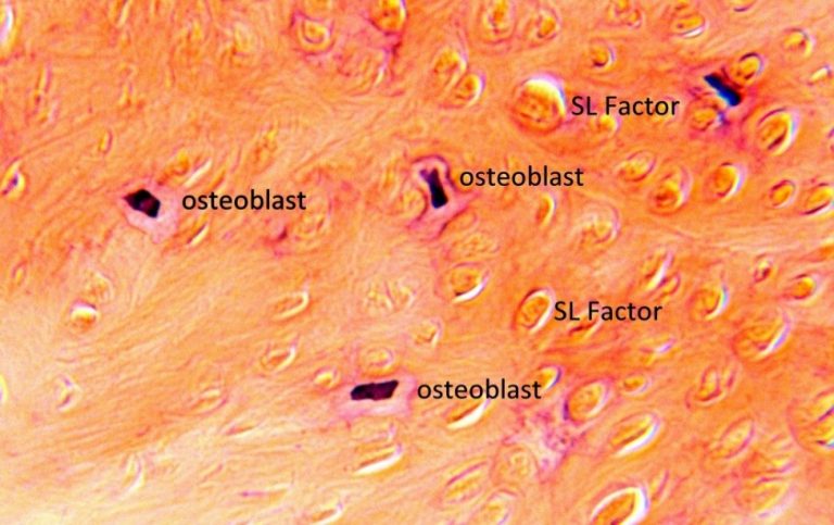 What is a Bone Graft?