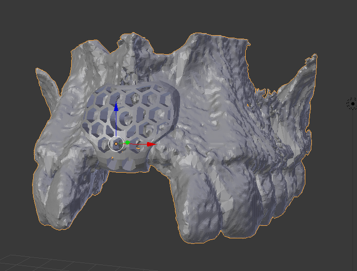 SteinerBio™ | Simple Ridge Augmentation