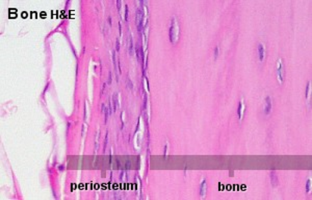 The Periosteum for Regenerating Periodontal Lesions