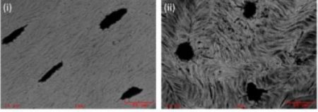 Understanding Sclerotic Bone | SteinerBio™