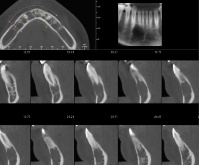 Managing Severe Lesions and Delayed Growth: Innovative Regenerative ...